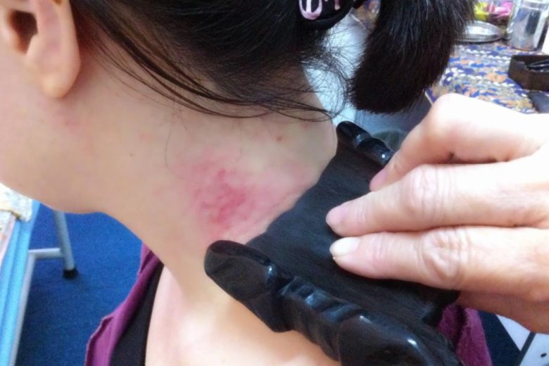 10 Kedai Ubat Tradisional Cina Terbaik Berdekatan PJ & KL 2025 ...