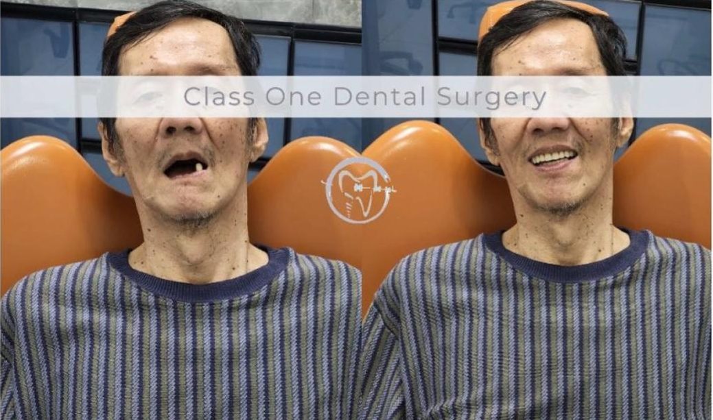 Top 10 Best Dental Clinics in Melaka | Updated 2026